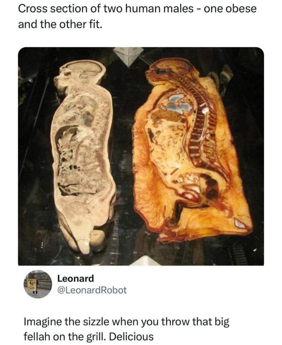 The best Anatomy memes :) Memedroid