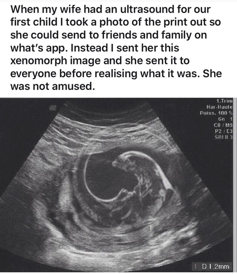The best Ultrasound memes :) Memedroid