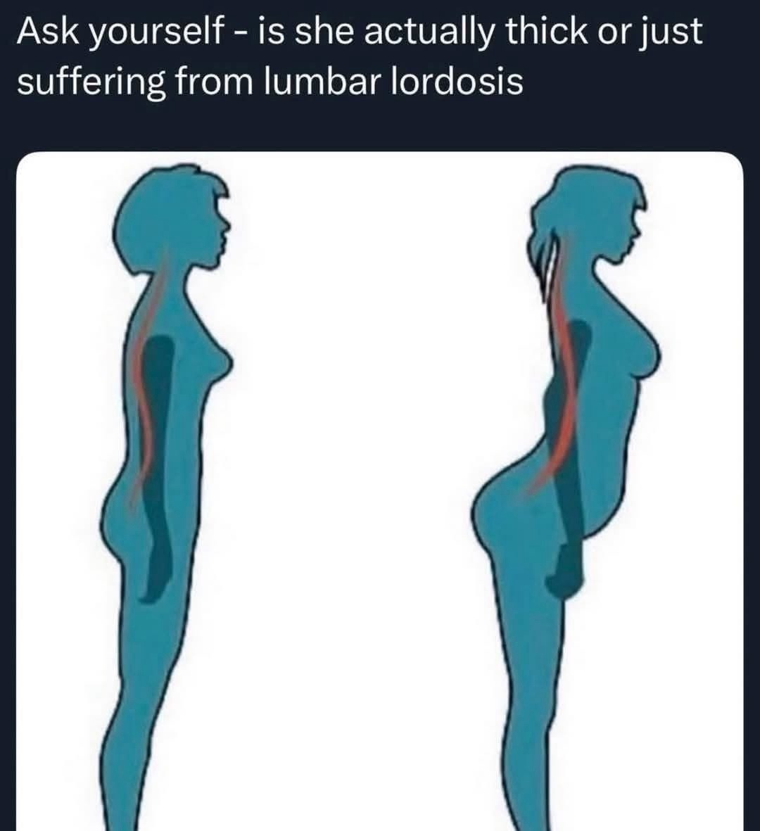 The best Lordosis memes :) Memedroid