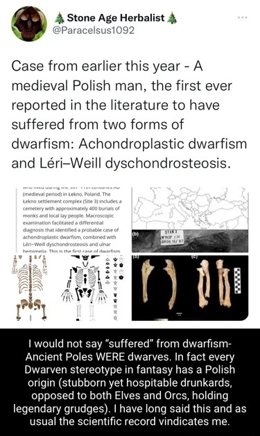 The best Dwarfs memes :) Memedroid